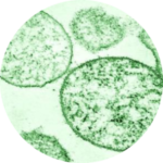 Ureaplasma urealyticum/parvum – bakteryjne zakażenie układu moczowo ...